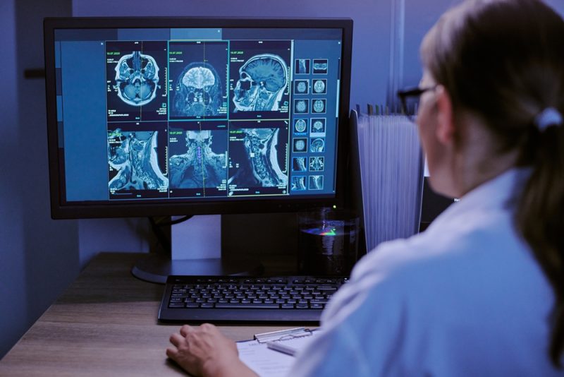 AI will make medical scan report twice as easy for patients to ...